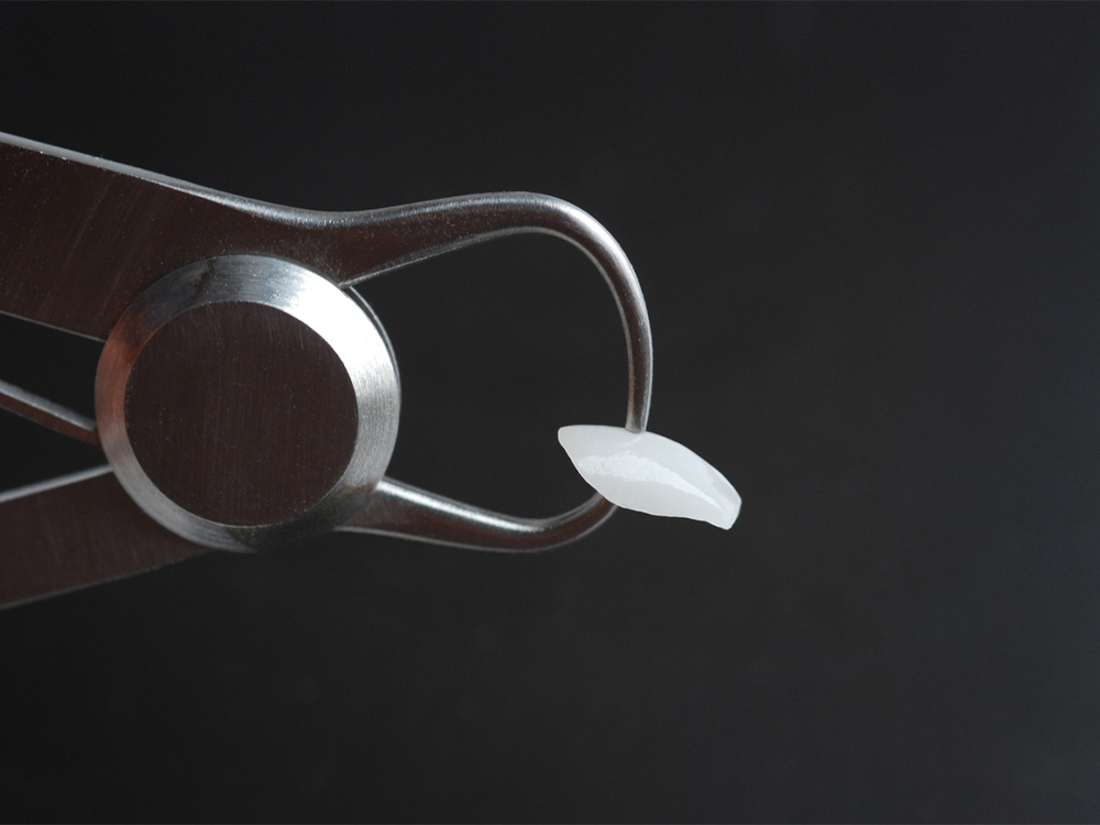 Porcelain Vs Composite Veneers Prince Dental